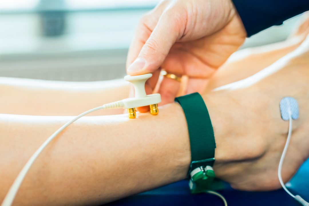 Wann ist eine NLG/EMG Untersuchung nötig?